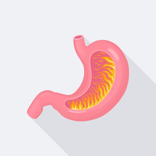 Vibrant Gastric Anatomy Illustration | Jiffy Designs