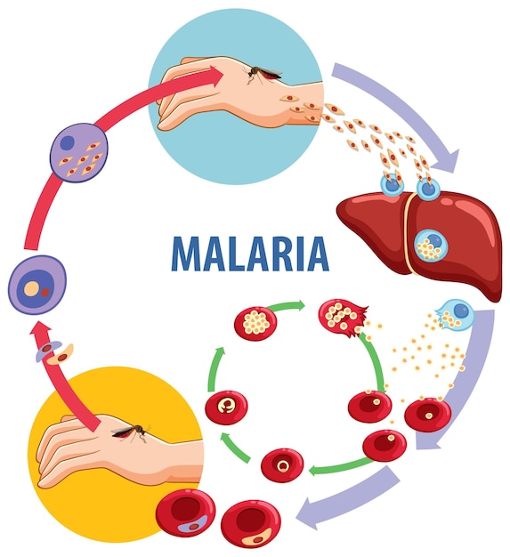 Malaria: A Comprehensive Visual Guide to the Disease | Jiffy Designs