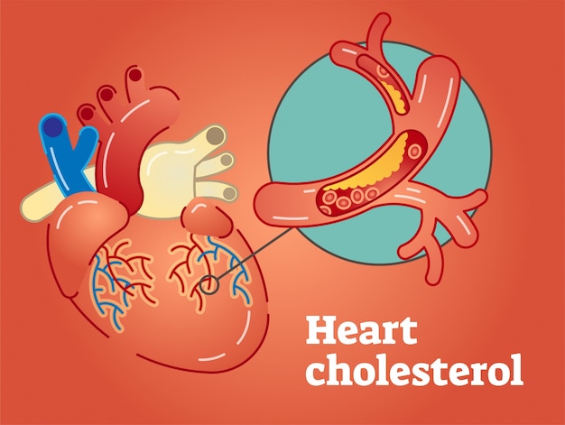 Vibrant Illustration of the Human Heart and Cholesterol | Jiffy Designs