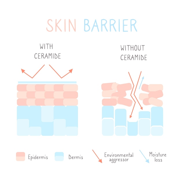 Skin Barrier Comparison: Ceramide's Protective Role Illustrated | Jiffy ...