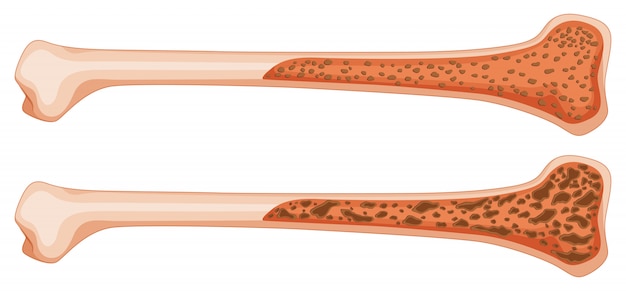 Detailed Illustration of Bone Structure with Intricate Patterns | Jiffy ...