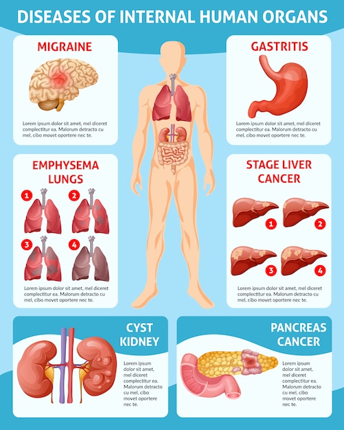 Detailed Illustrations of Common Internal Organ Diseases | Jiffy Designs