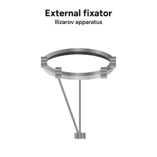 Sturdy and Versatile External Fixator Device for Medical Applications ...