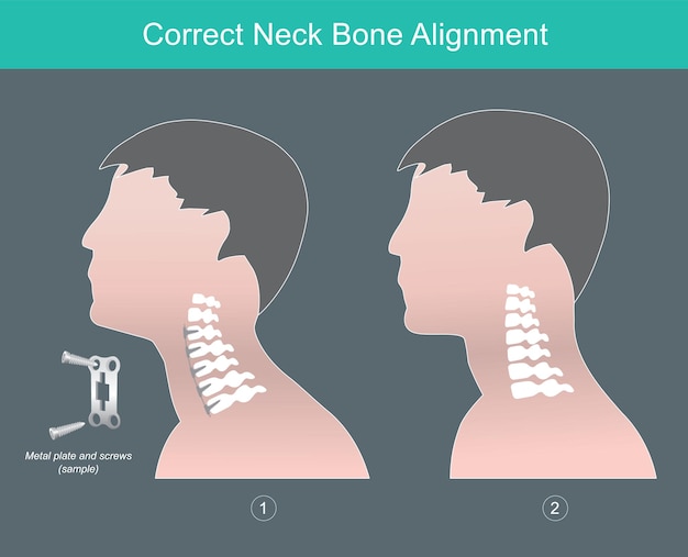 Illustrated Guide to Proper Neck Posture and Alignment | Jiffy Designs