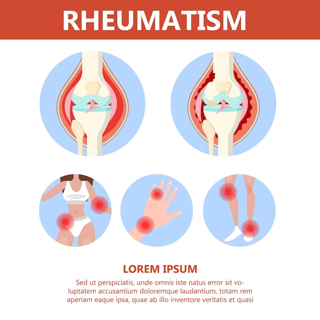 Detailed Illustrations Depicting the Symptoms of Rheumatism | Jiffy Designs