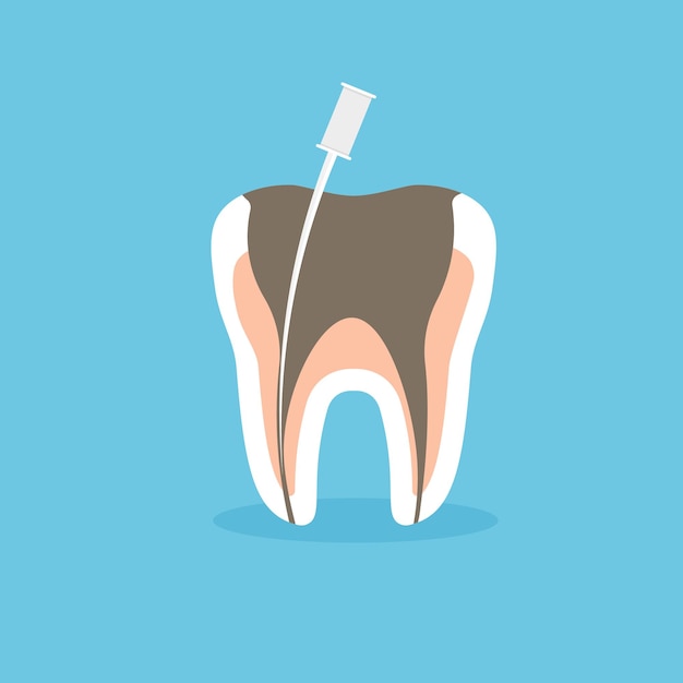 Detailed Illustration of a Healthy Tooth with Dental Probe | Jiffy Designs
