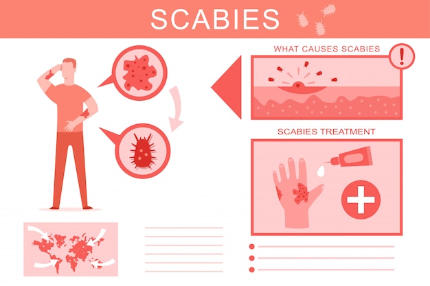 Detailed Guide to Understanding and Treating Scabies Skin Condition | Jiffy Designs