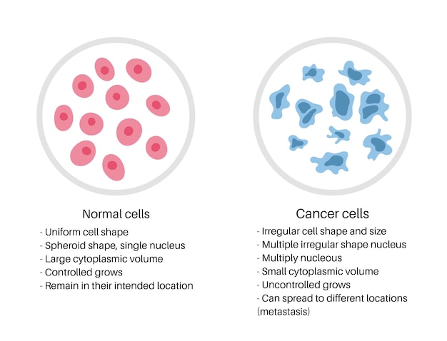 Microscopic Comparison: Normal Cells and Cancerous Cells | Jiffy Designs